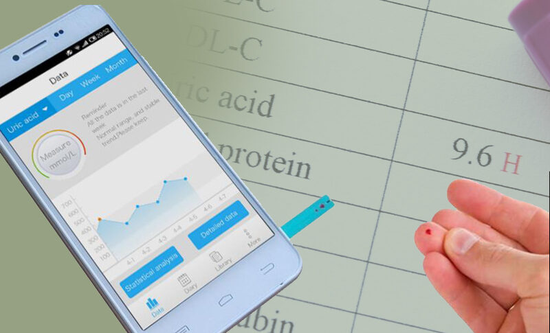New Bio-Electronic Uric Acid Detecting Device Fabricated By Indian ...